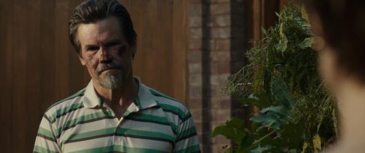 EVEREST (2015) - Beck Weathers' (Josh Brolin) 'Frost Bite' Prosthestic ...