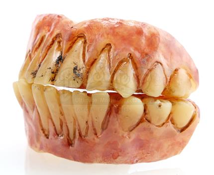 TRUE BLOOD (2008 - 2014) - Goblin Teeth Dental Appliances and Case ...